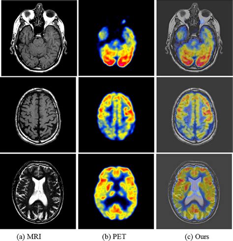 Adf‐net Attention‐guided Deep Feature Decomposition Network For Infrared And Visible Image