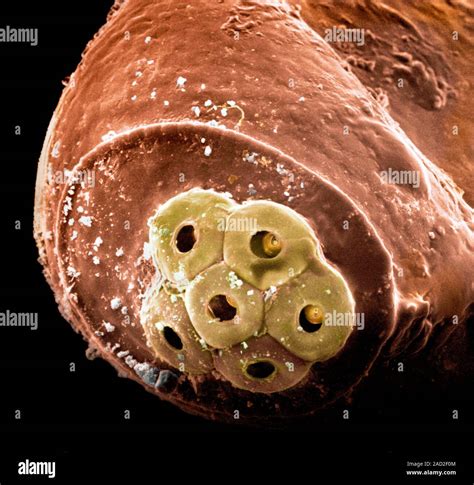 Scanning Electron Microscope Image Of A Head Louse Pediculus Humanus Capitis Egg Colourised