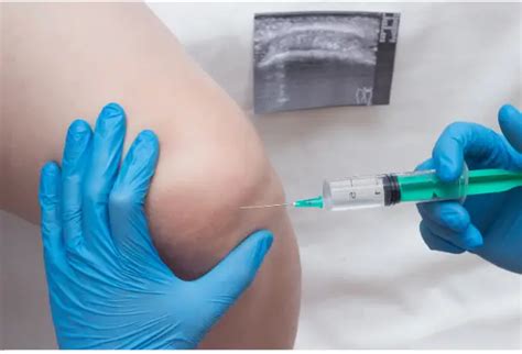 Monovisc Knee Injection All You Need To Know Med Supply Solutions