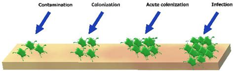 Treatment Strategies For Infected Wounds