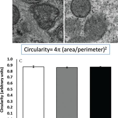 Gingival Mitochondria With A Low A Or High Level B Of Circularity