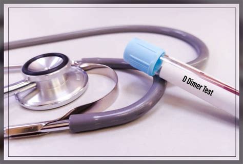 D Dimer Test Definition Diagnosis And What To Expect Egiomed