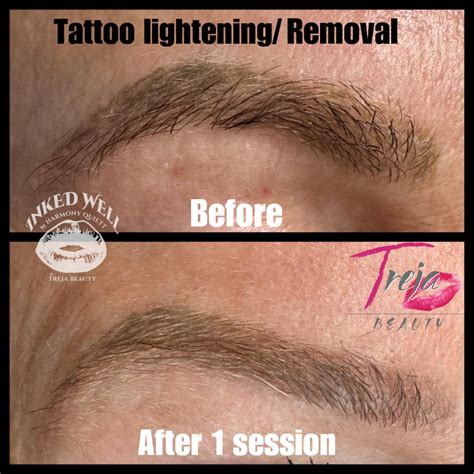 Whats The Best Method For Removing Permanent Makeup Treja Beauty