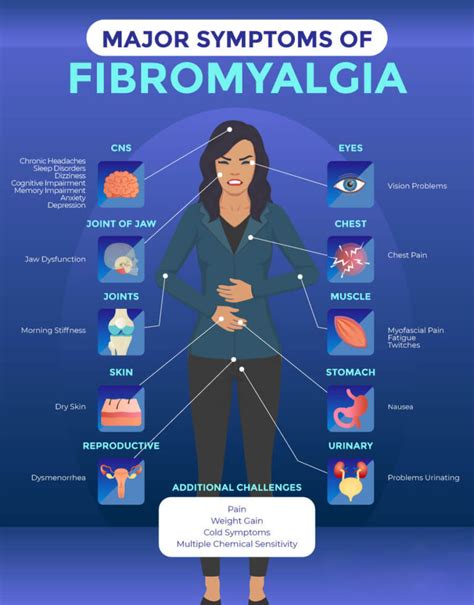 Navigating Relief A Comprehensive Guide To Medications For Fibromyalgia