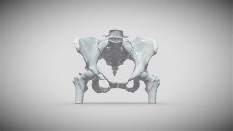 Pelvis Fracture Buy Royalty Free 3d Model By Dr Samuel Damin Sdamin [6ad2b1f] Sketchfab