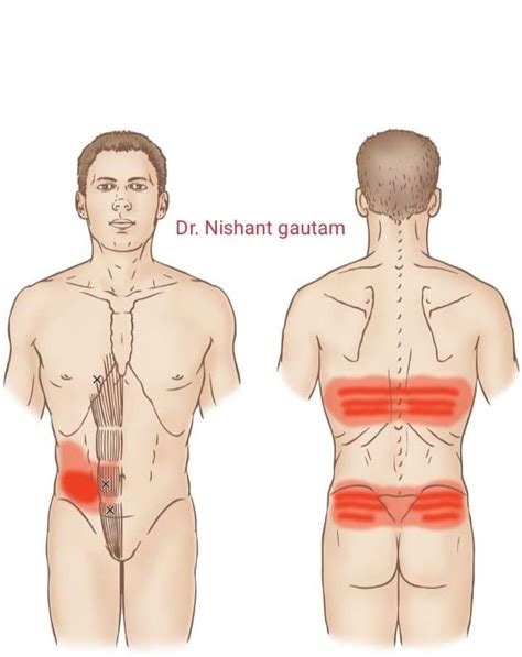 Pin By Jennifer Steffensen Kight On Trigger Points Trigger Points Flexibility Workout