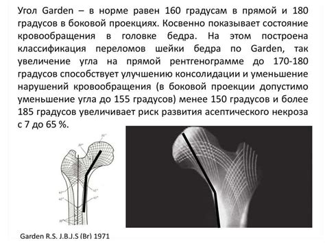 Анатомия тазобедренного сустава Online Presentation