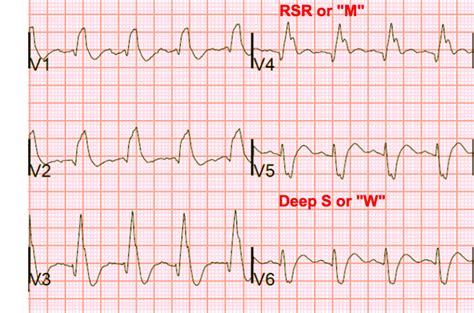 Ecg Faqs Get The Gas
