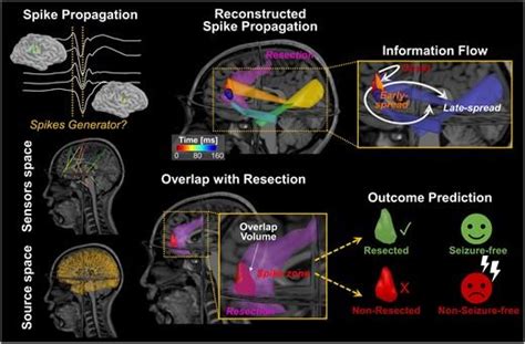 Spike Propagation Mapping Reveals Effective Connectivity And Predicts Marta Jarkiewicz