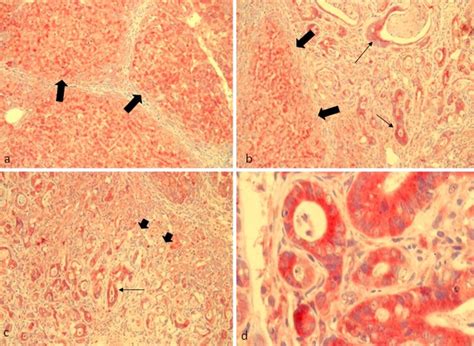 Immunohistochemical Detection Of Epo With Alkaline Phosphatase