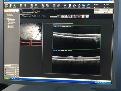 Optometry Designed Eyes Optometrist And Spectacle Maker In Rosebud