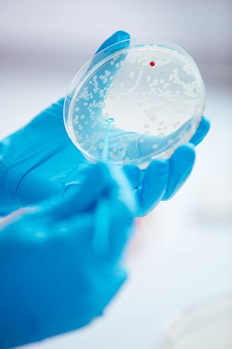 실험실에 있는 과학자의 손에 의해 페 트리 접시의 접종 루프와 재배 페트리 접시에 대한 스톡 사진 및 기타 이미지 페트리 접시 접시 과학 Istock