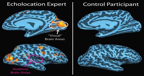 Echolocation Acts As Substitute Sense For Blind People Neuroscience News