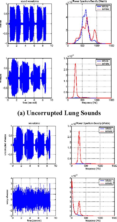 Figure 3 From Lung Sound Noise Separation For Anesthesia Respiratory Monitoring Semantic Scholar