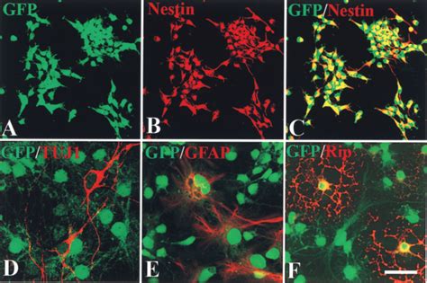 Npcs Culture And Differentiation Pattern In Vitro Ac Npcs Were