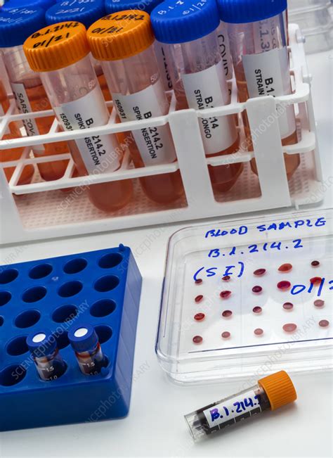 sars cov 2 variant research conceptual image stock image f036 3539