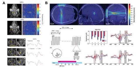 Transcranial Focused Ultrasound Stimulation Of Human 42 Off