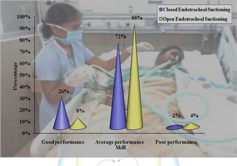 Figure 2 From Effectiveness Of Closed Versus Open Endotracheal