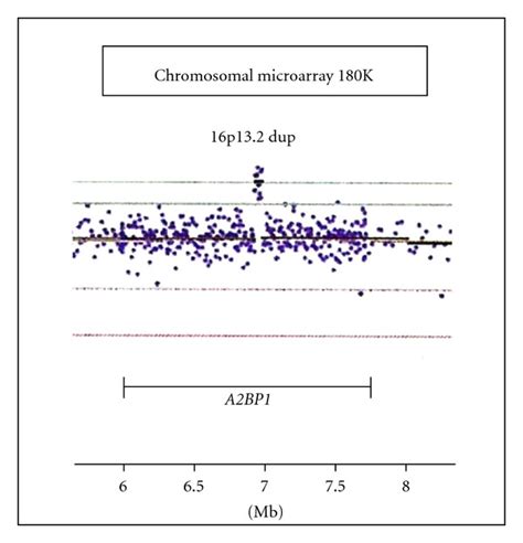 Chromosomal Microarray Analysis Of The Proband Showed A 53 Kb Download Scientific Diagram