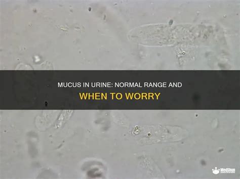 Mucus In Urine Normal Range And When To Worry Medshun