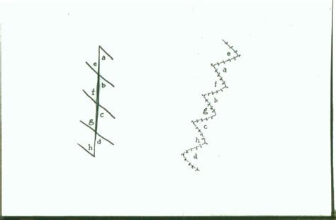 带蒂皮瓣的设计与移植，一文搞定！ 德医医学 助力医学教育发展！