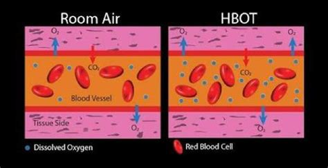 Low Pressure Hyper Cube Westminster Co Amazone Functional Health