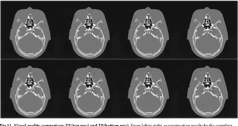 Figure 11 From Tensor Framelet Based Iterative Image Reconstruction