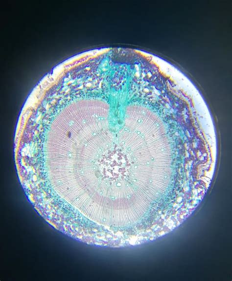 First Time Using A Microscope Here Are Some Picture I Took D R