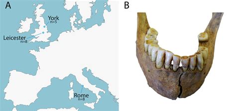 Dental Calculus Archaeology Dental Calculus Archaeology