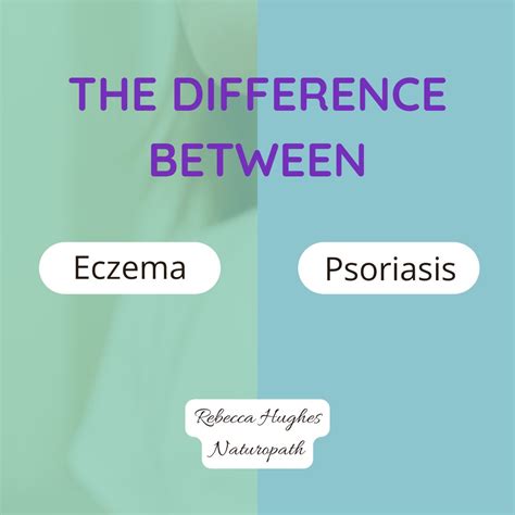 Natural Understanding Skin Eczema Vs Guttate Psoriasis Skin