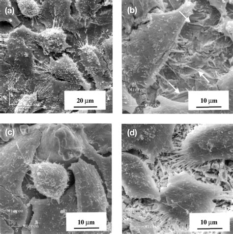 Scanning Electron Microscopy Images 20006 Showing The Morphology And
