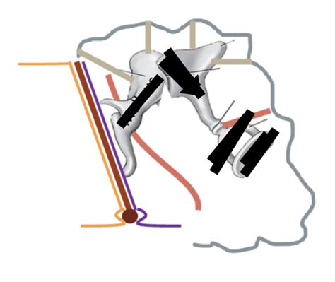 Ossicular Chain Anatomy Diagram Quizlet