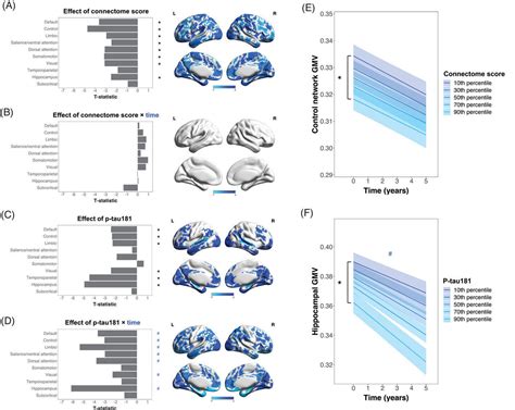 Brain Connectome Phenotype Linked To Cerebrovascular Disease Can Track