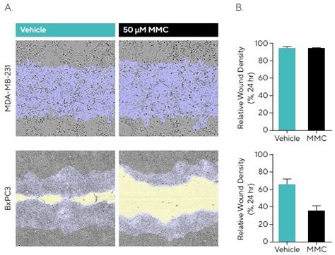 Quantifying Cell Migration In Real Time