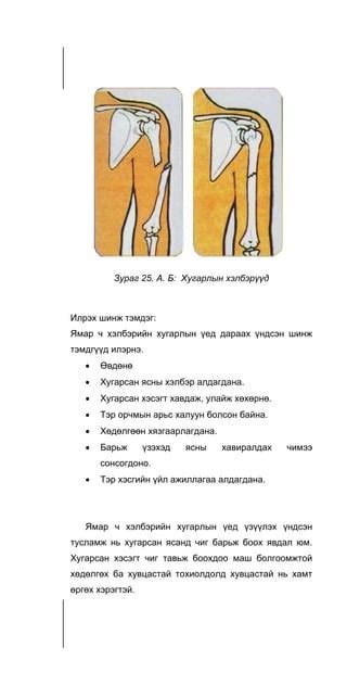 Осол гэмтлийн үед үзүүлэх анхны тусламж Pdf