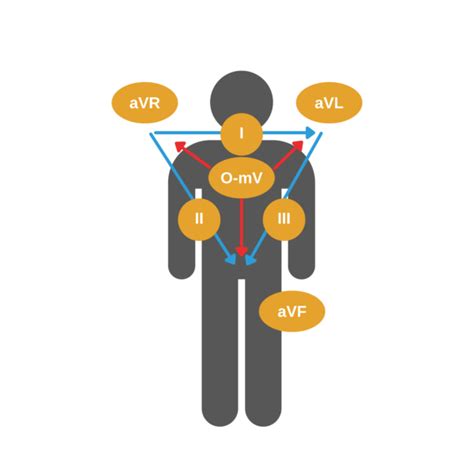 Topic The Cardiac Axis 12 Lead Ecg Course Acls Certification