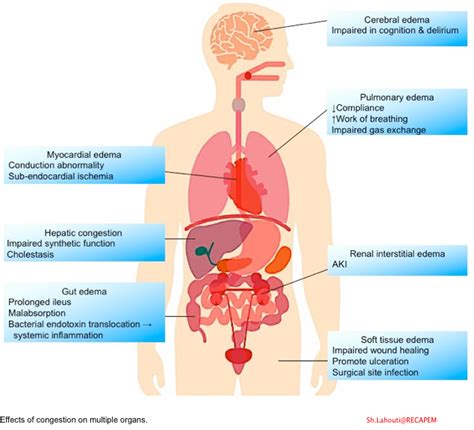 The Realm Of Tissue Perfusion Systemic Hypoperfusion And Congestion The Realm Of Tissue Perfusion Systemic Hypoperfusion And Congestion