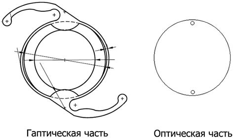 Fig Schematic Representation Of Modular Iol Components Haptic And Download Scientific Diagram