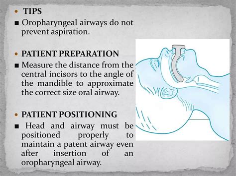 Pediatric Airway Management Pptx