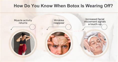 Botox Lifespan How Long Can You Expect Results Best Female Plastic Surgeon In Dubai Dr
