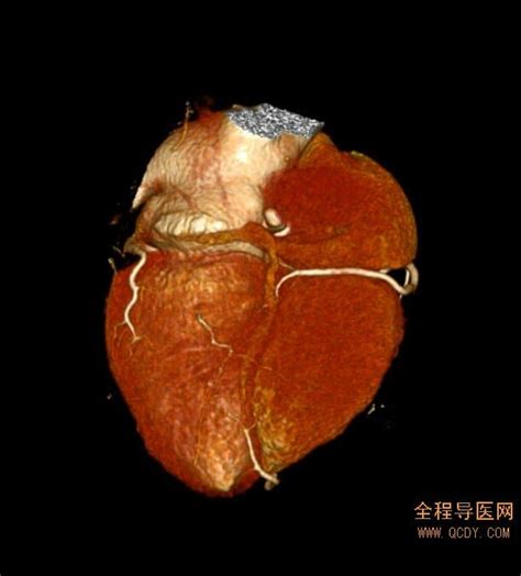 徐医附院双源ct：心脏冠脉造影检查10189人次 全程导医网