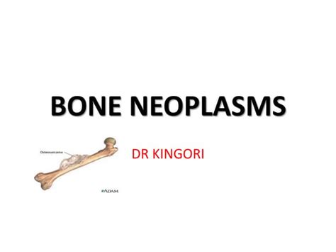 11 Bone Neoplasms In Medical Pathologypptx 11 Bone Neoplasms In Medical Pathologypptx