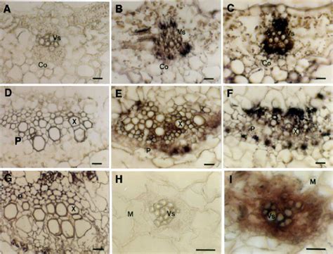 In Situ Localization Of Calrr1 Mrnas In Leaf Stem And Green Fruit