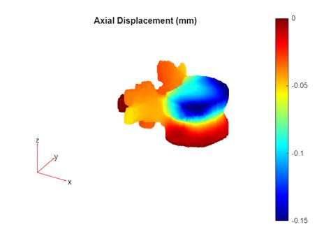 Medical Image Based Finite Element Analysis Of Spine Matlab And Simulink