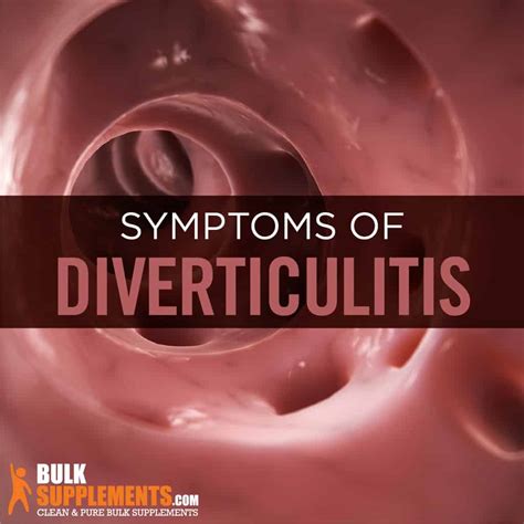 What Does Diverticulitis Mean In English Dwjve