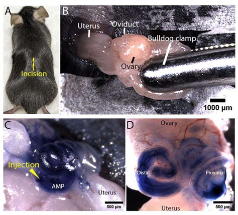 Somatic Genome Engineered Mouse Models Using In Vivo Microinjection And Electroporation