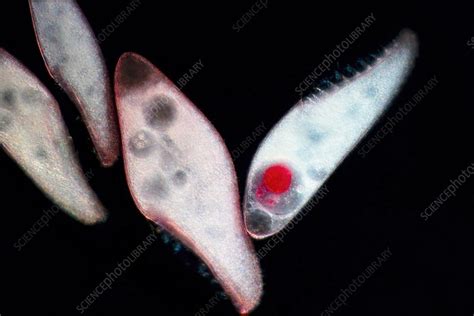 Blepharisma Americana Protozoan Light Micrograph Stock Image C052 3449 Science Photo Library