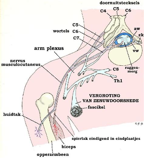 Aandoeningen Van Perifere Zenuwen En De Plexus Neurochirurgisch Centrum Nijmegen