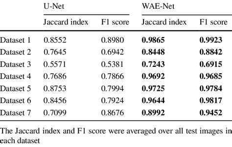 Segmentation Performance Comparison Between Wae Net And U Net