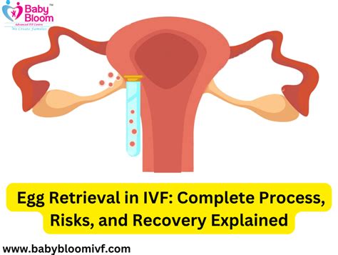Egg Retrieval In Ivf Complete Process Risks And Recovery